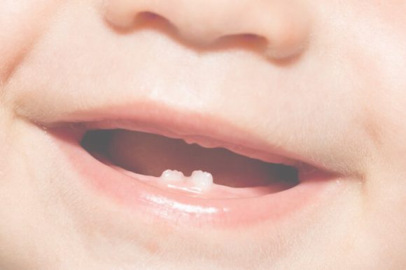 ¿Qué es el flúor? Principales consejos de uso para una buena salud bucal
