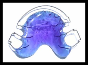 Tipos de retenedores dentales , uso y precio de estos